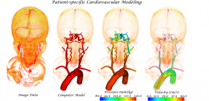 Patient-specific Blood Flow Simulation – Computational Vascular ...